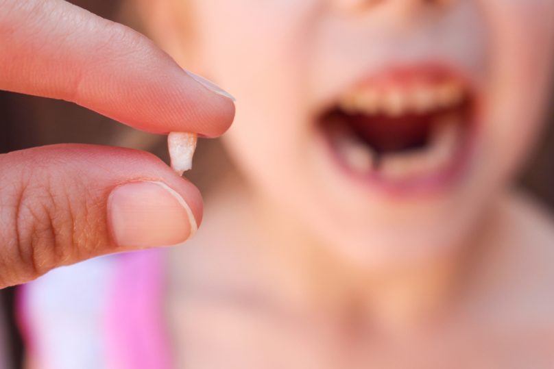 Baby teeth: the age they fall out, the sequence of losing them and some ...