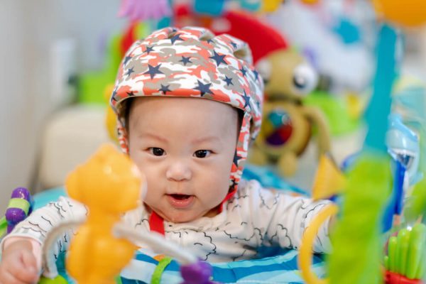 Why Do Babies Wear Helmets? Helmet Therapy for Babies | Findmykids