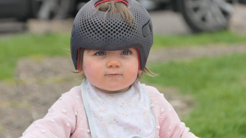 Why Do Babies Wear Helmets? Helmet Therapy for Babies | Findmykids