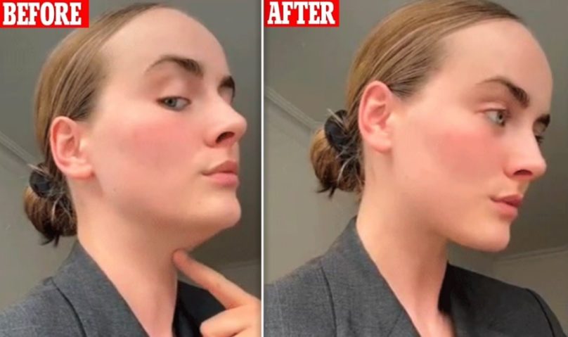 What is Mewing: Meaning Over TikTok Trend. How Do Teens Use it at ...