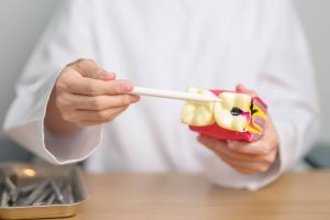 The Silver Tooth Kid Trend: What It Is and Why Kids Have Silver Crowns ...